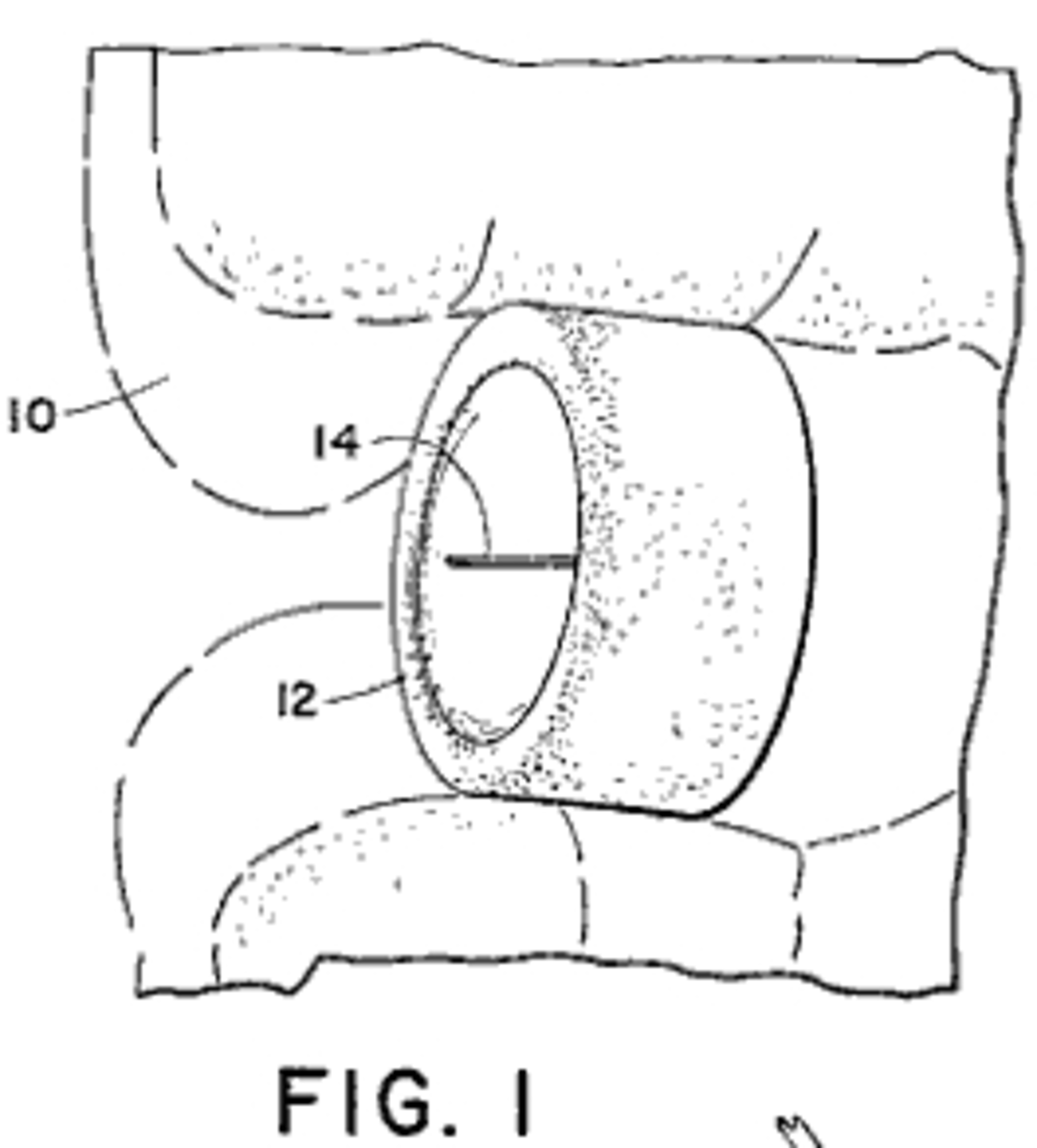 Anti-Rape Device or Vagina Spaceship? - Washington City Paper